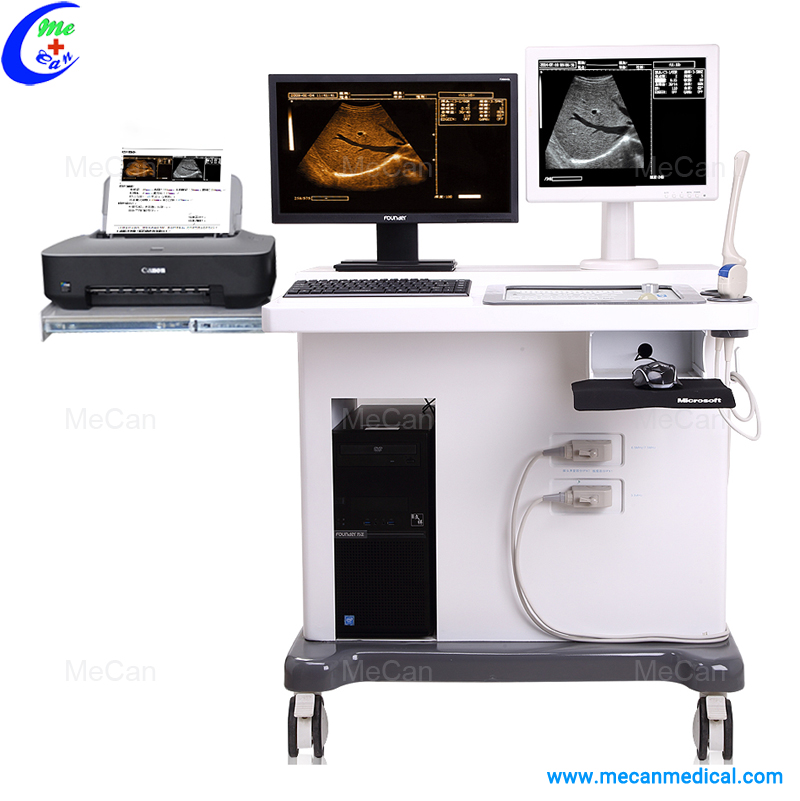 Trolley Ultrasound Scanner with Workstation