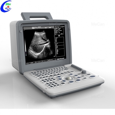 Medical Diagnostic Portable B Ultrasound Machine For Pregnancy
