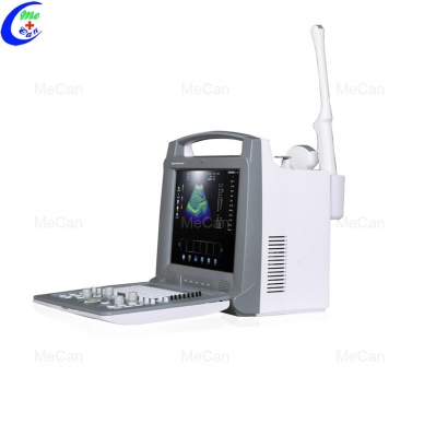 Portable 2D Echo Machine Echocardiography Machine