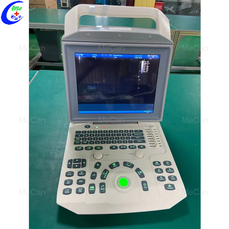 Portable Full Digital Black and White Ultrasound Machine Manufacturer | MeCan