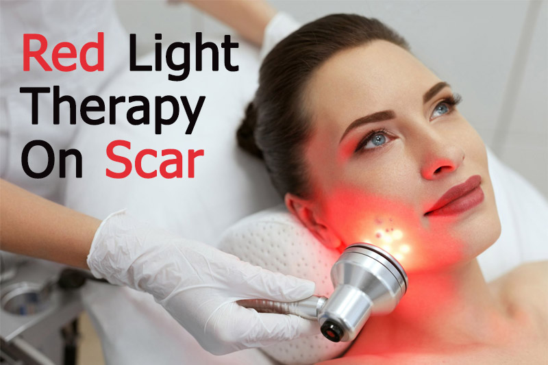 Does Light Therapy Help with Scars? | REDDOT LED