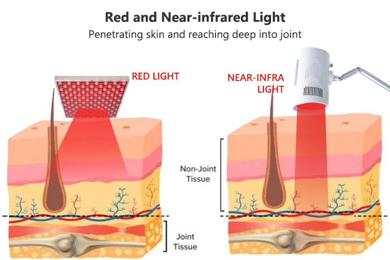 Red Light Therapy for Arthritis: Does It Work? | REDDOT LED