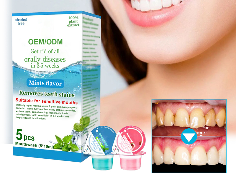 Mints Flavor Removes Teeth Stains Jelly Cup Mouthwash | Roeasy