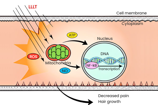 Understanding Low-Level Laser Therapy (LLLT): Benefits & How It Works