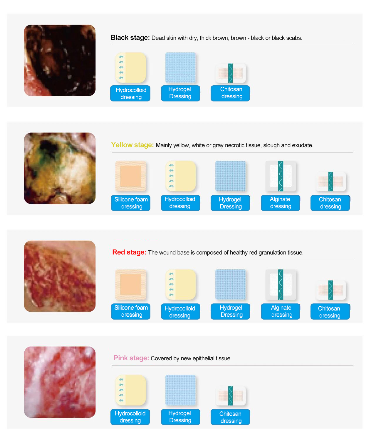 Ultimate Guide to Wound Care Staging and Wound Dressing Selection