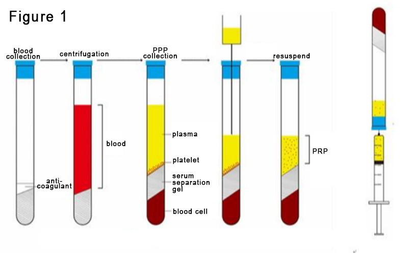 Conceptos y aplicaciones de PRP, CPT y PRF