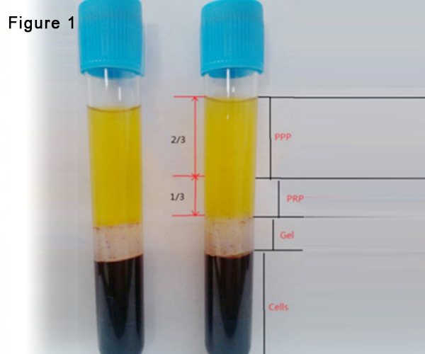 Concepts and Applications of PRP, CPT, and PRF