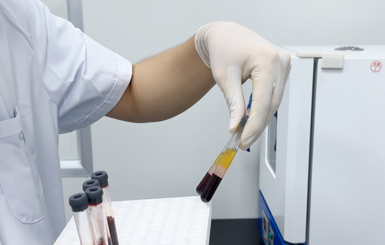 Fibrin: Common Causes and Handling Methods | TH Biol